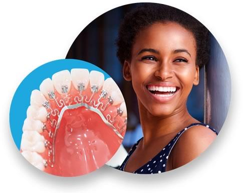 Brava by Brius, Braces, Invisalign | Fusion Orthodontics