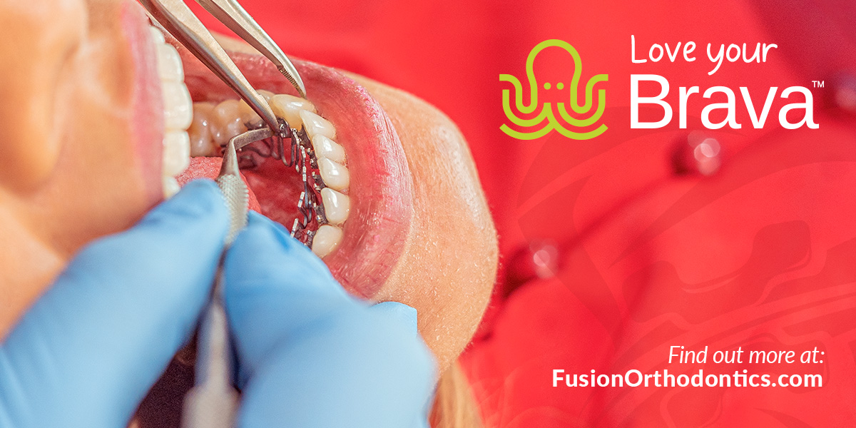 Brava by Brius - The Faster Alternative to Traditional Braces