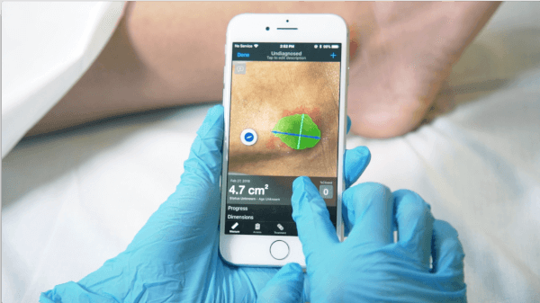 Swift Medical is Reimagining Patient Care with AI-Powered Wound ...