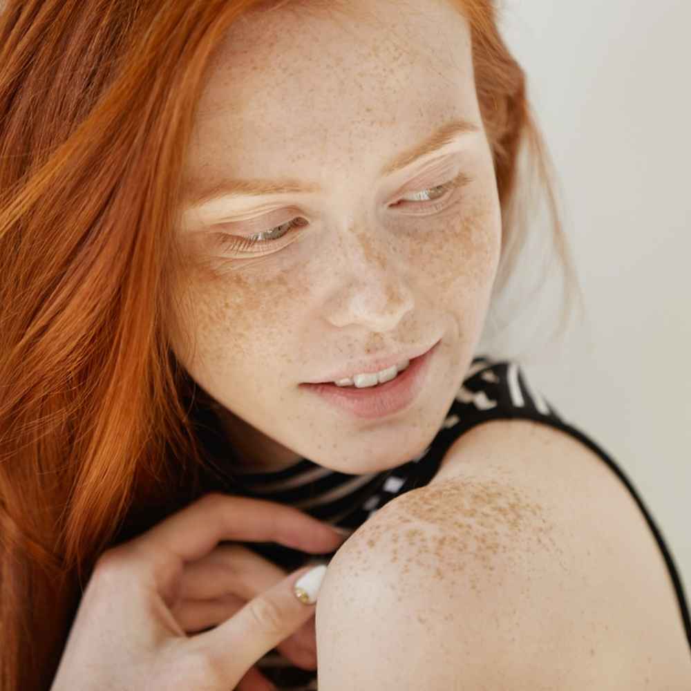 Love Your Freckles Day 2024