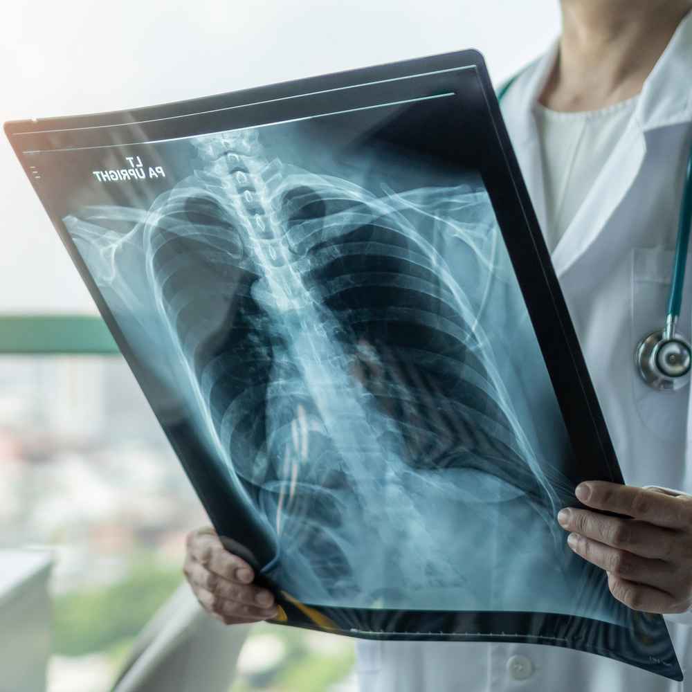 Lung Health Day 2024