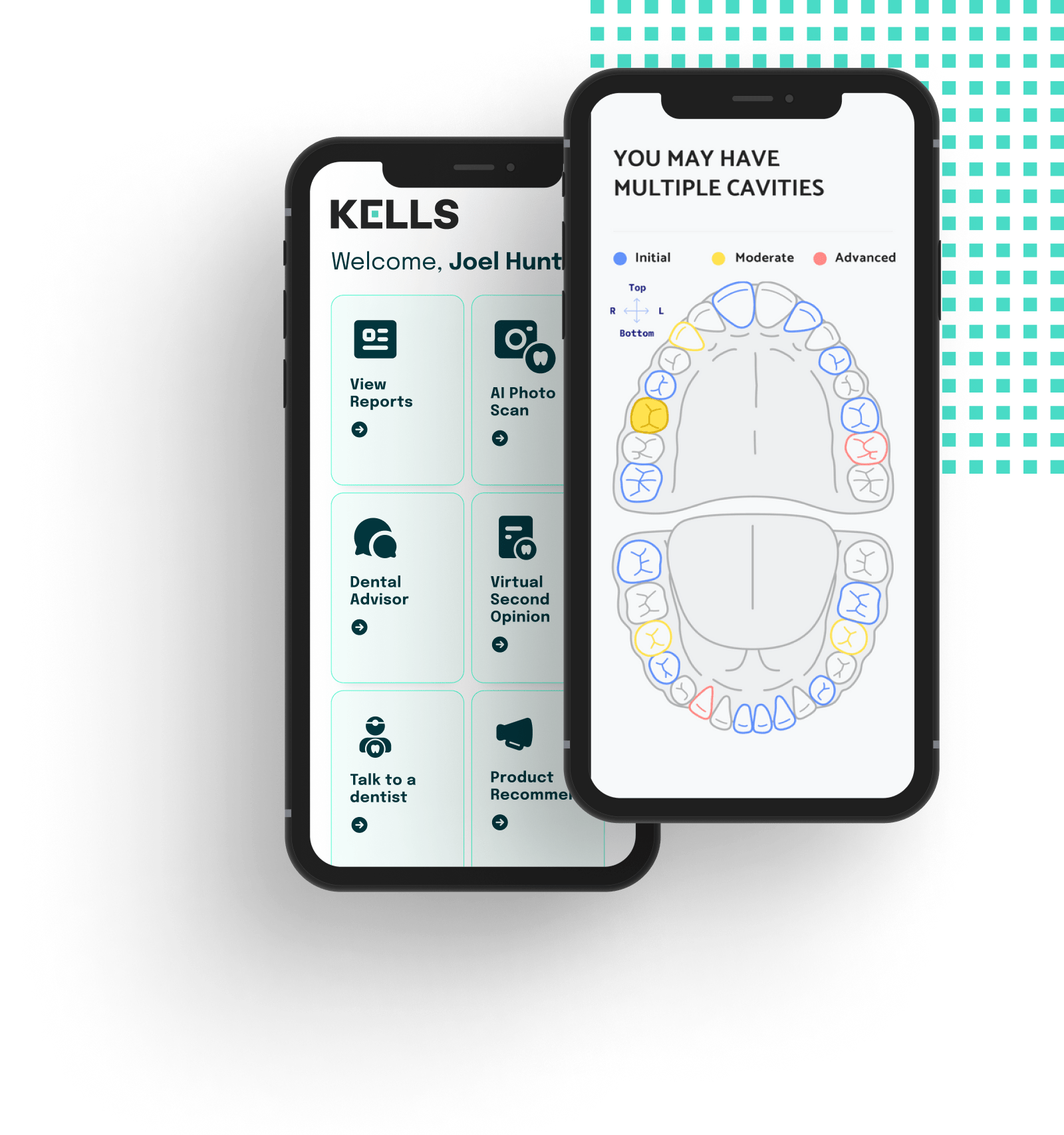 KELLS: AI-powered Next Generation Virtual Dental Care