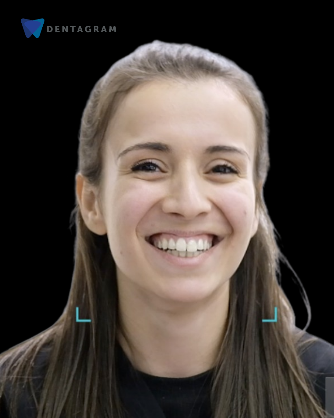 Gamze Kul - Dental nurse