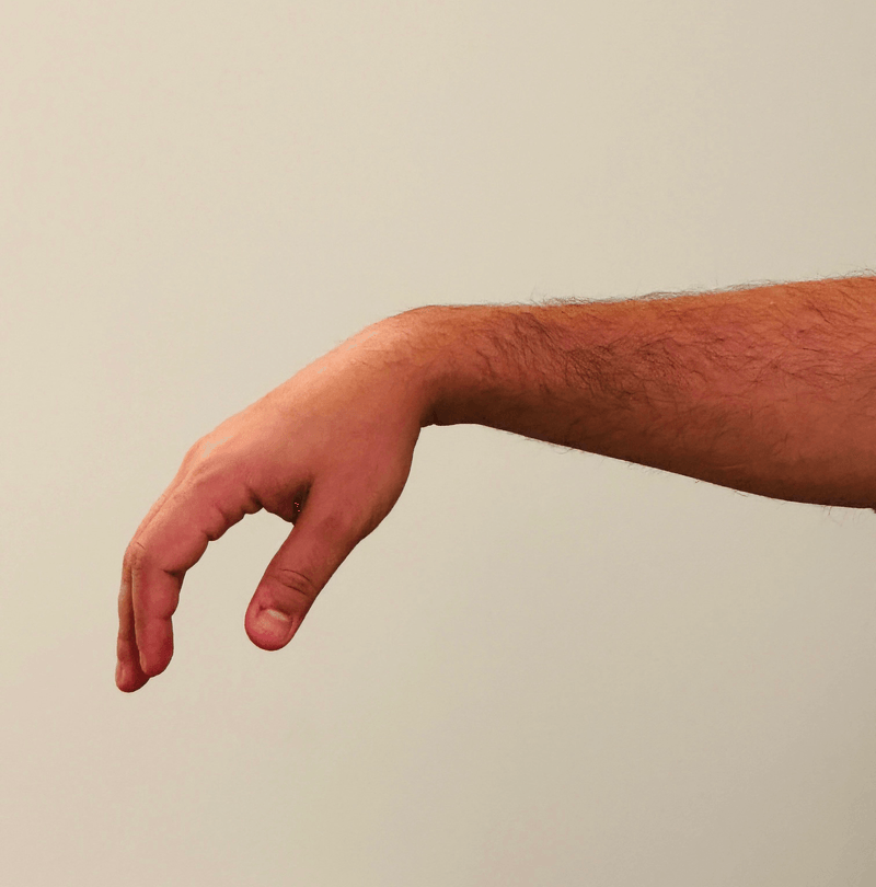 Radial Neuropathy | BC Centre for Complex Nerve Injury