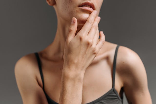 Drug Absorption Through The Skin