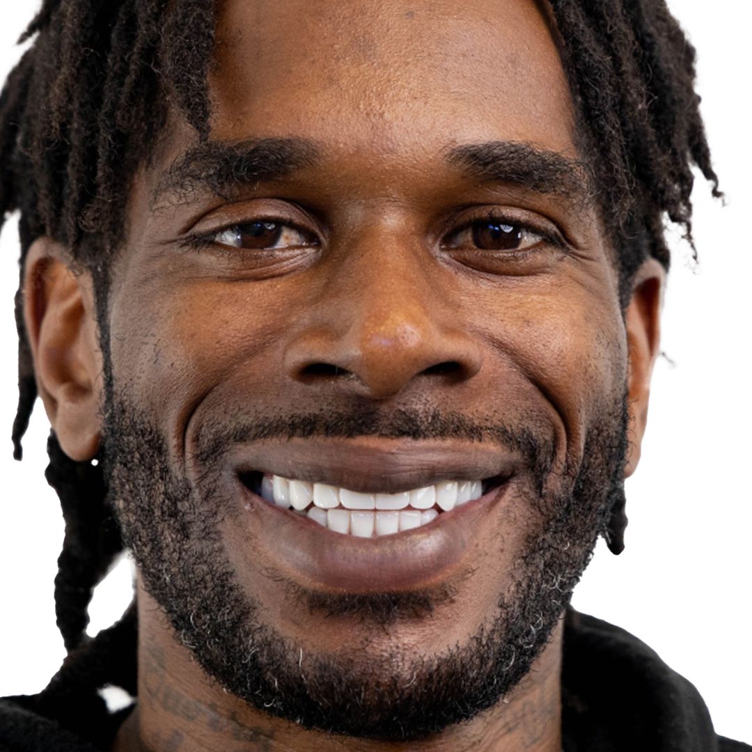 24-Hour Permanent Teeth with Dental Implants in Salt Lake City