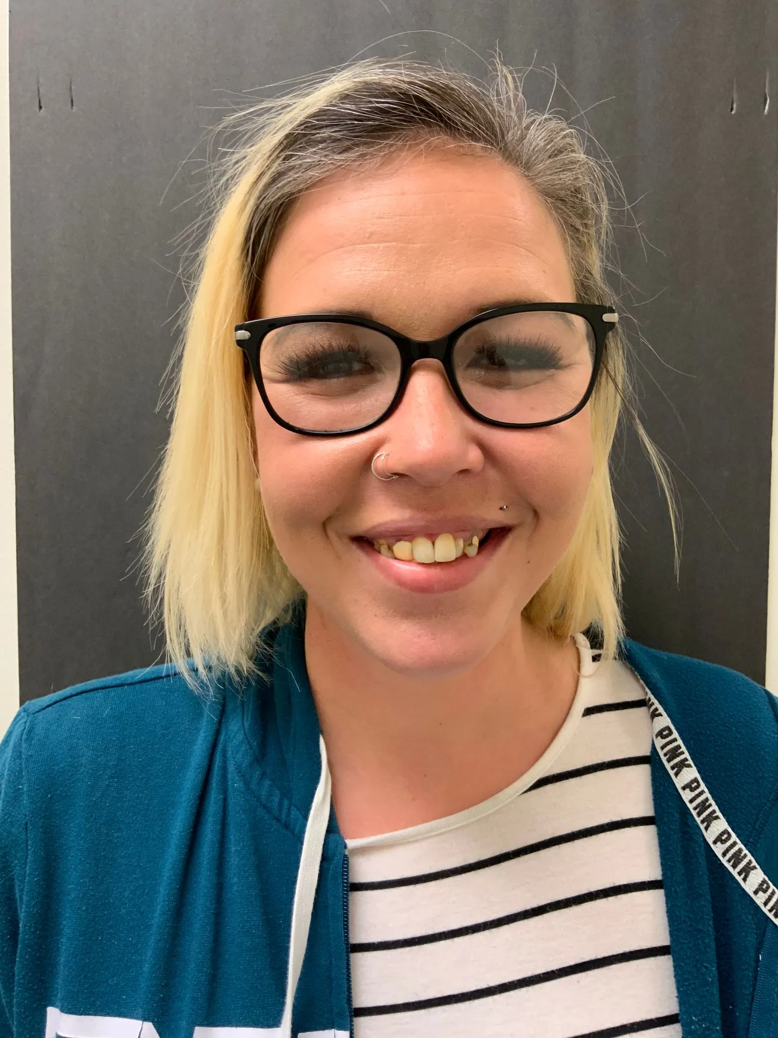 Dental Implant Cost And Information Guide