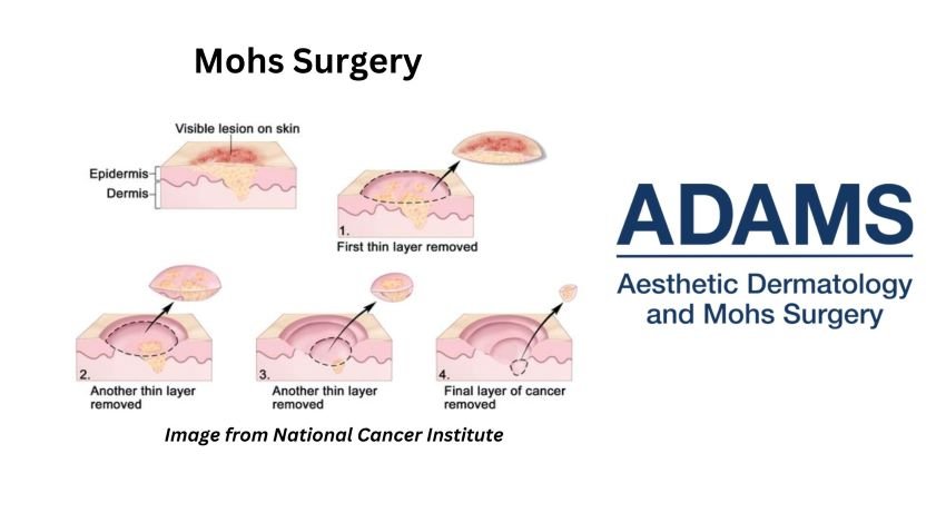 Adam J. Tinklepaugh, MD - ADAMS