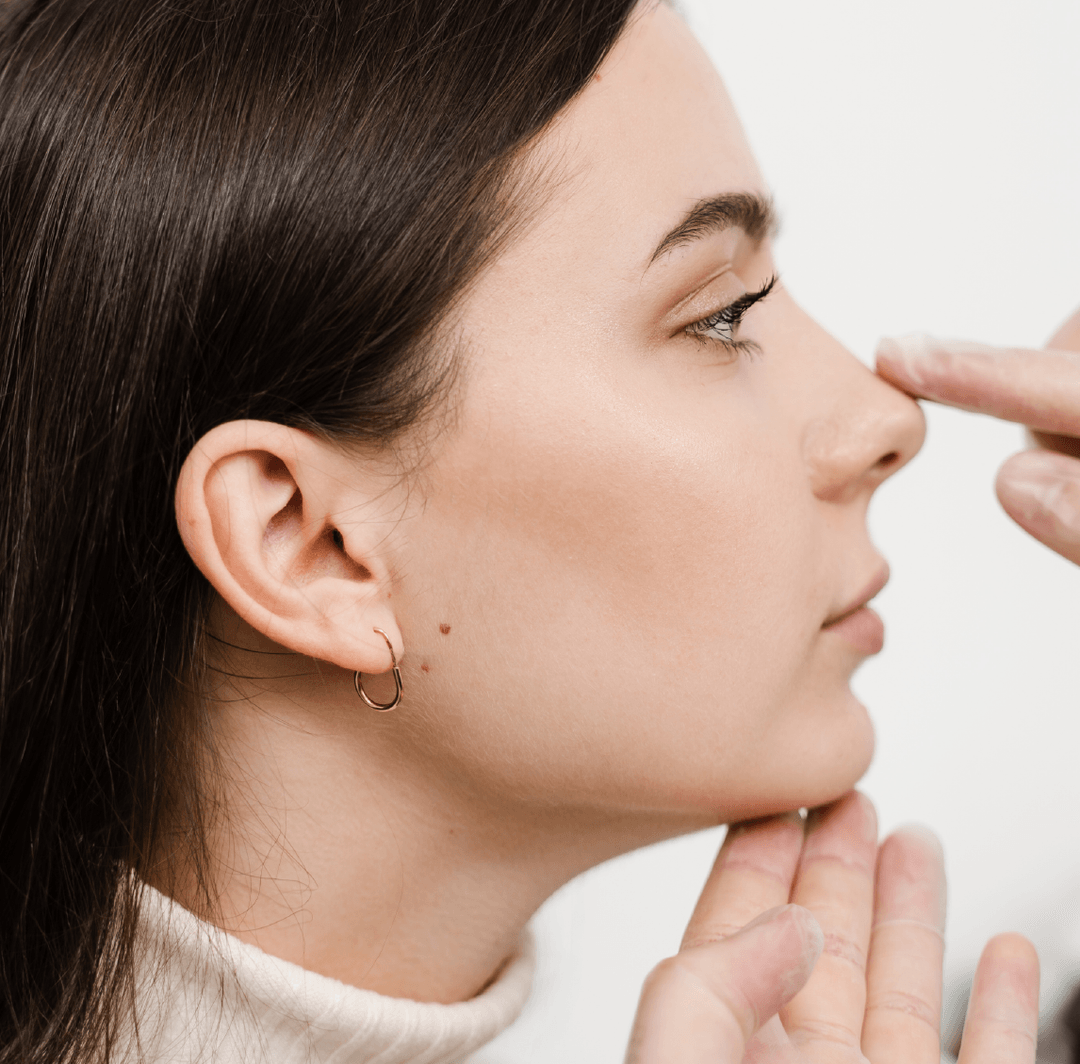 Nose Lift PDO Threads - Silver Sweet Clinic