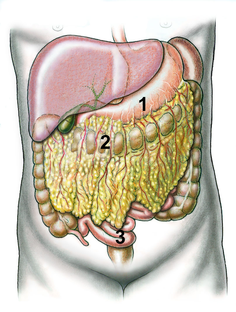 VISCERA – Krankheiten – Tumorbefall des grossen Netzes