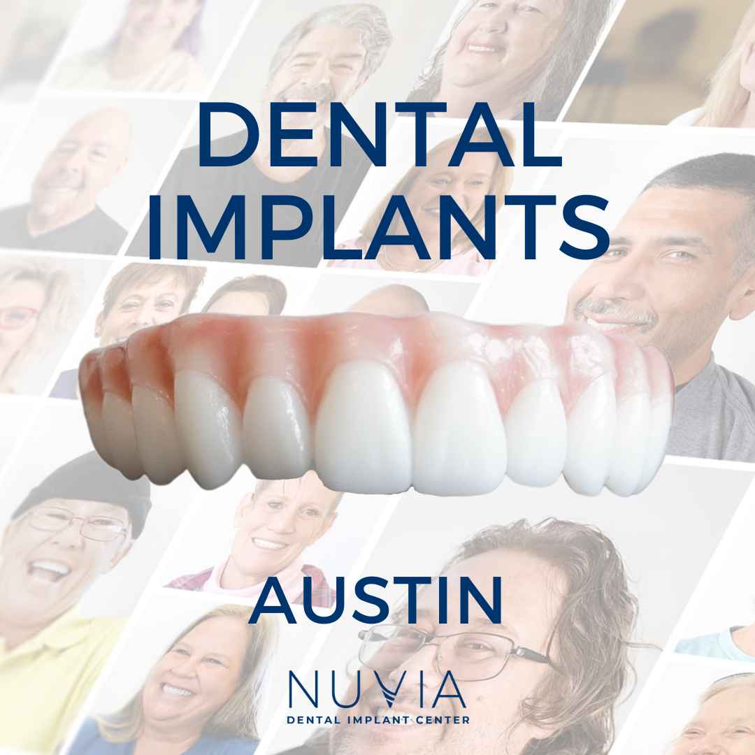Dr. Matthew Krieger At Nuvia Dental Implant Center