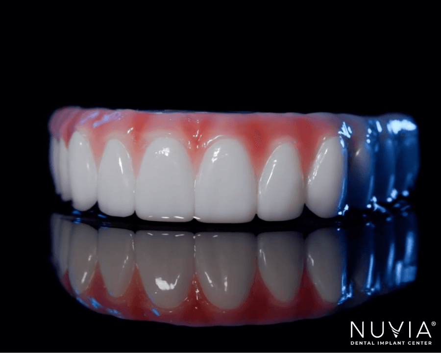 Dentures vs. Permanent Teeth in 24 Hours