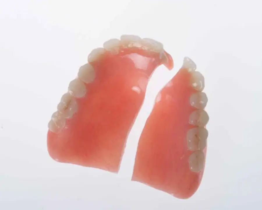 10 Things You Should Know Before Getting Dentures.