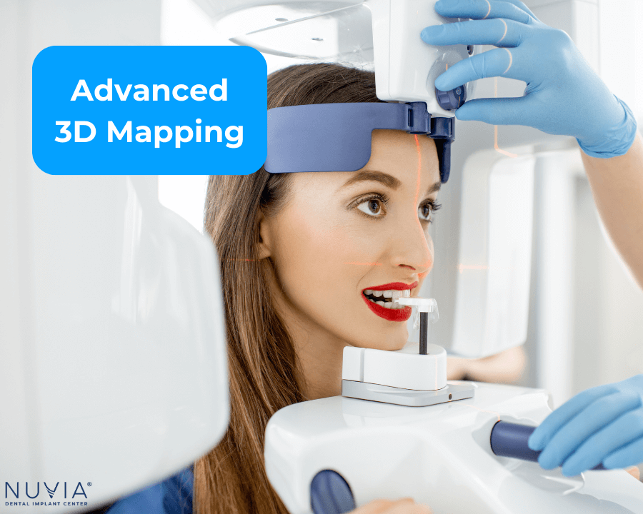 The Importance of CT Scan for Dental Implants Preparation