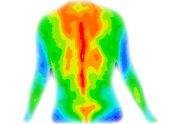 Swiss Clinical Thermology — Non-invasive Thermal Medical Imaging