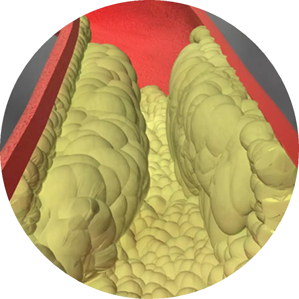 CIMT Testing | Nexus HealthSpan Wellness Center Orange County