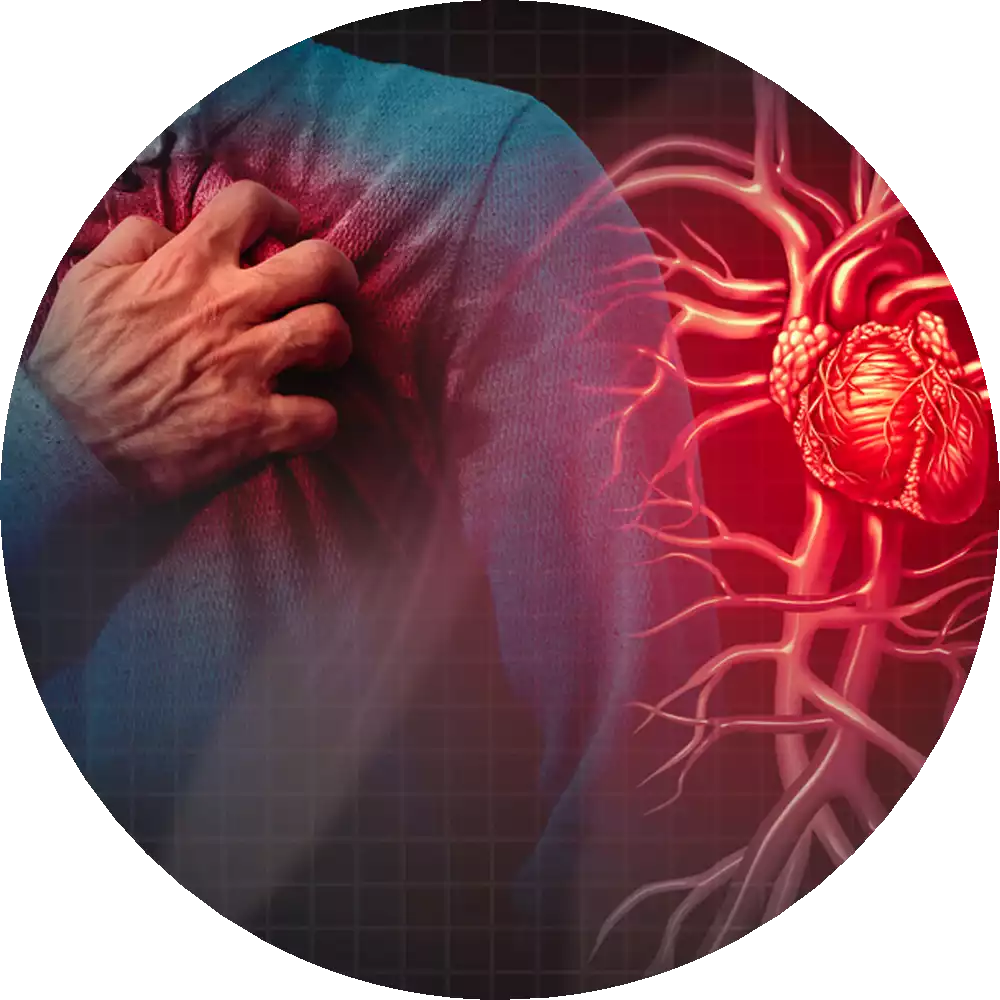Heart Attack Prevention | Nexus HealthSpan Wellness Center Orange County