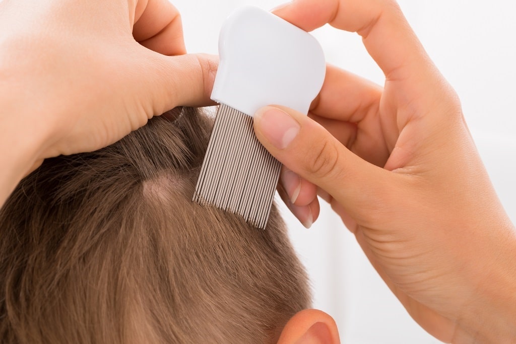 What to do If My Newborn Baby Has Lice: Natural Lice Treatment For ...