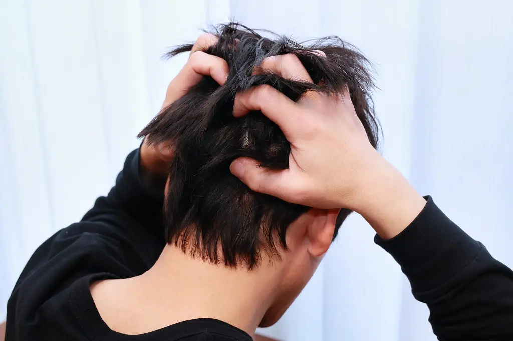 4 Reasons Why Your Head Still Itch After Lice Treatment | LiceDoctors ...