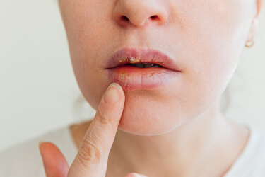 Dermatology Services in Charlottesville, VA