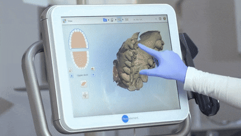 iTero Intraoral Scanner