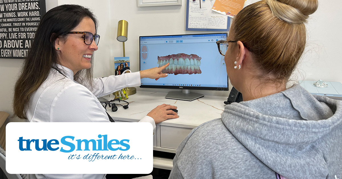 Before and After Smile Makeover | TrueSmiles