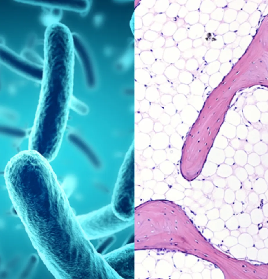 Additive Manufacturing of Ceramics for Biomedical | SiNAPTIC