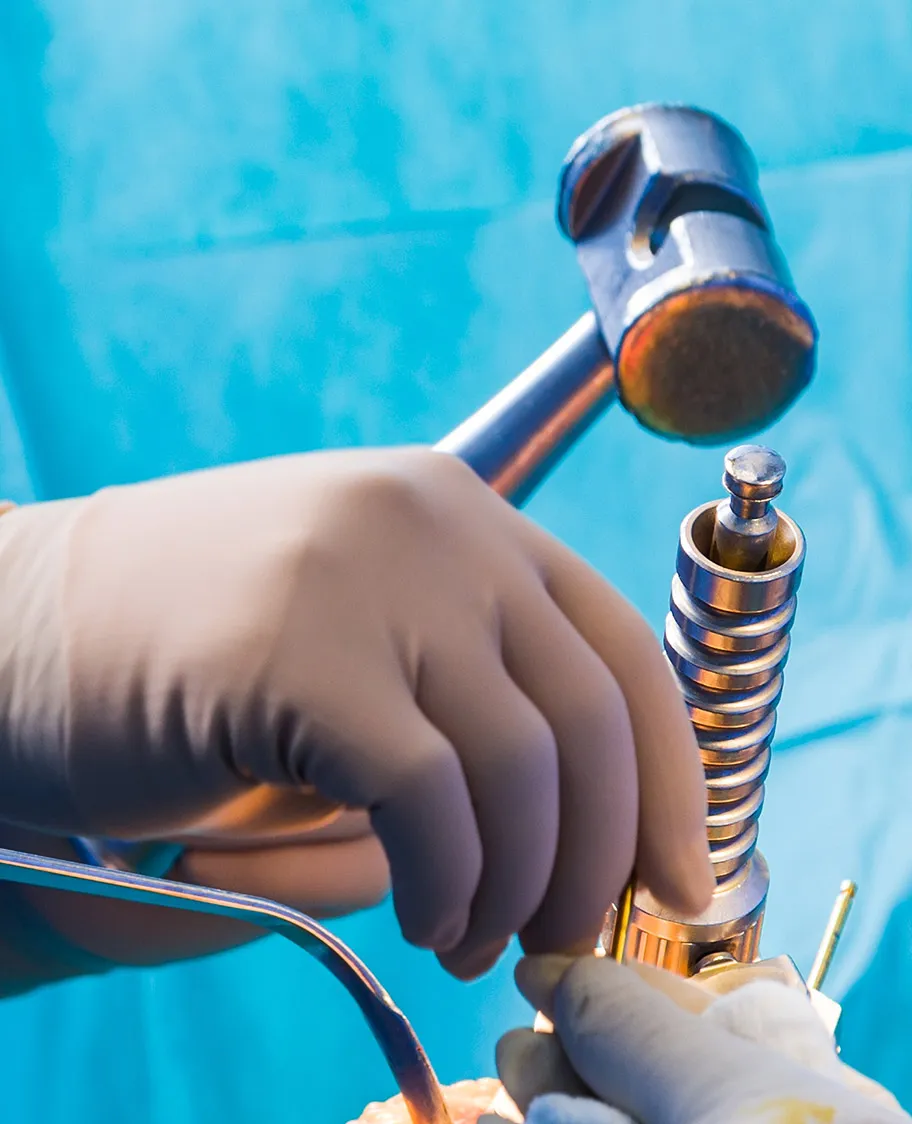 Additive Manufacturing of Ceramics for Biomedical | SiNAPTIC