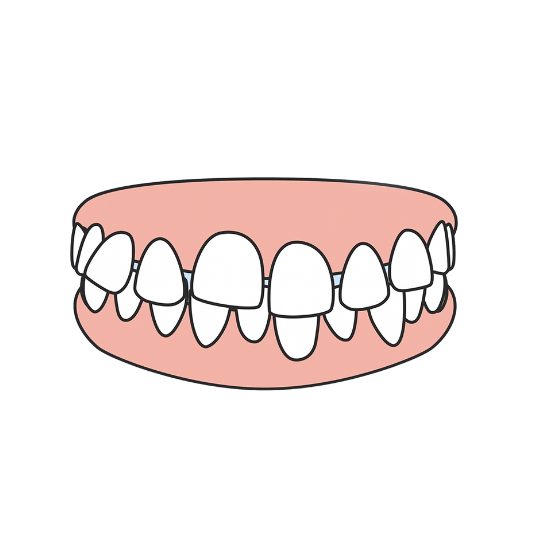 StraightMyTeeth: Your Guide to Teeth Straightening