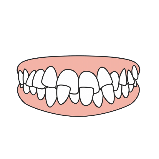 StraightMyTeeth: Your Guide to Teeth Straightening