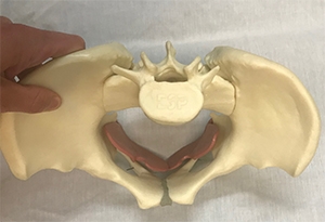 Sacroiliac (SI) Pain: Lower Back And Buttocks