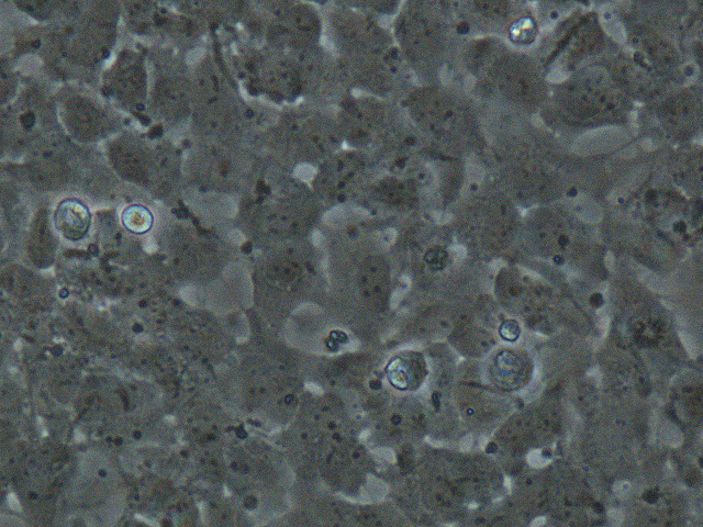 RenovaCare Inc (OTCMKTS:RCAR) Just Popped: Here's Why | Insider Financial