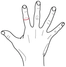 Finger Wrap [Double] (Finger support) | ZAMST