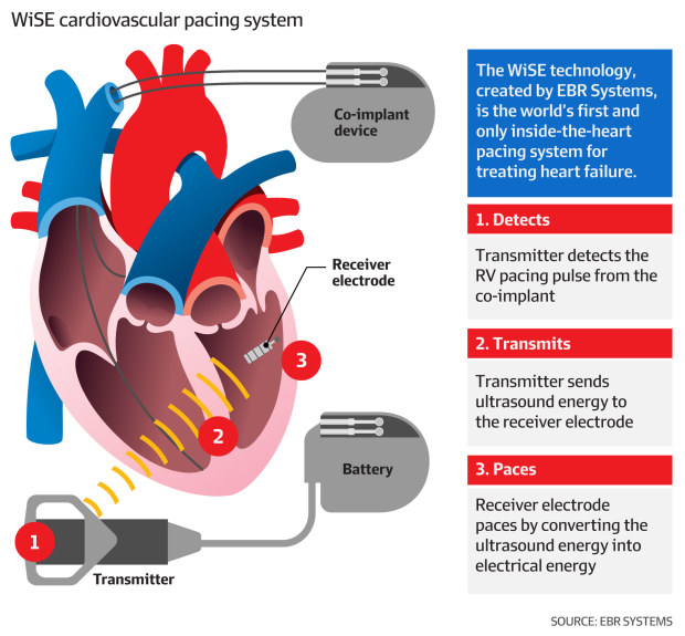 ‘Next Cochlear’ stock surges after heart device breakthrough