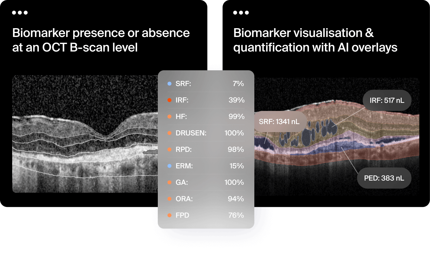 Transform unstructured data to healthcare insights with AI