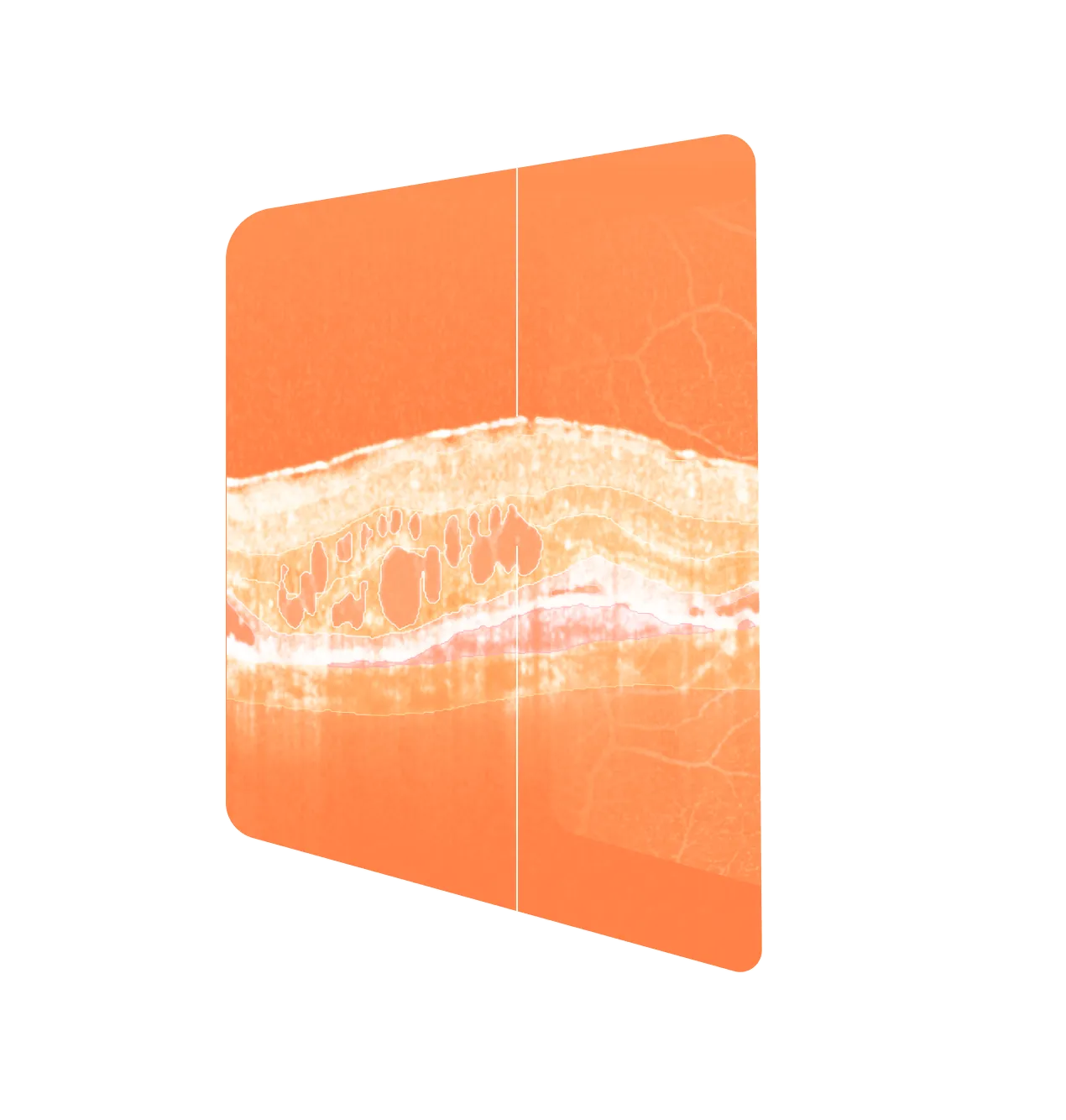 Transform unstructured data to healthcare insights with AI