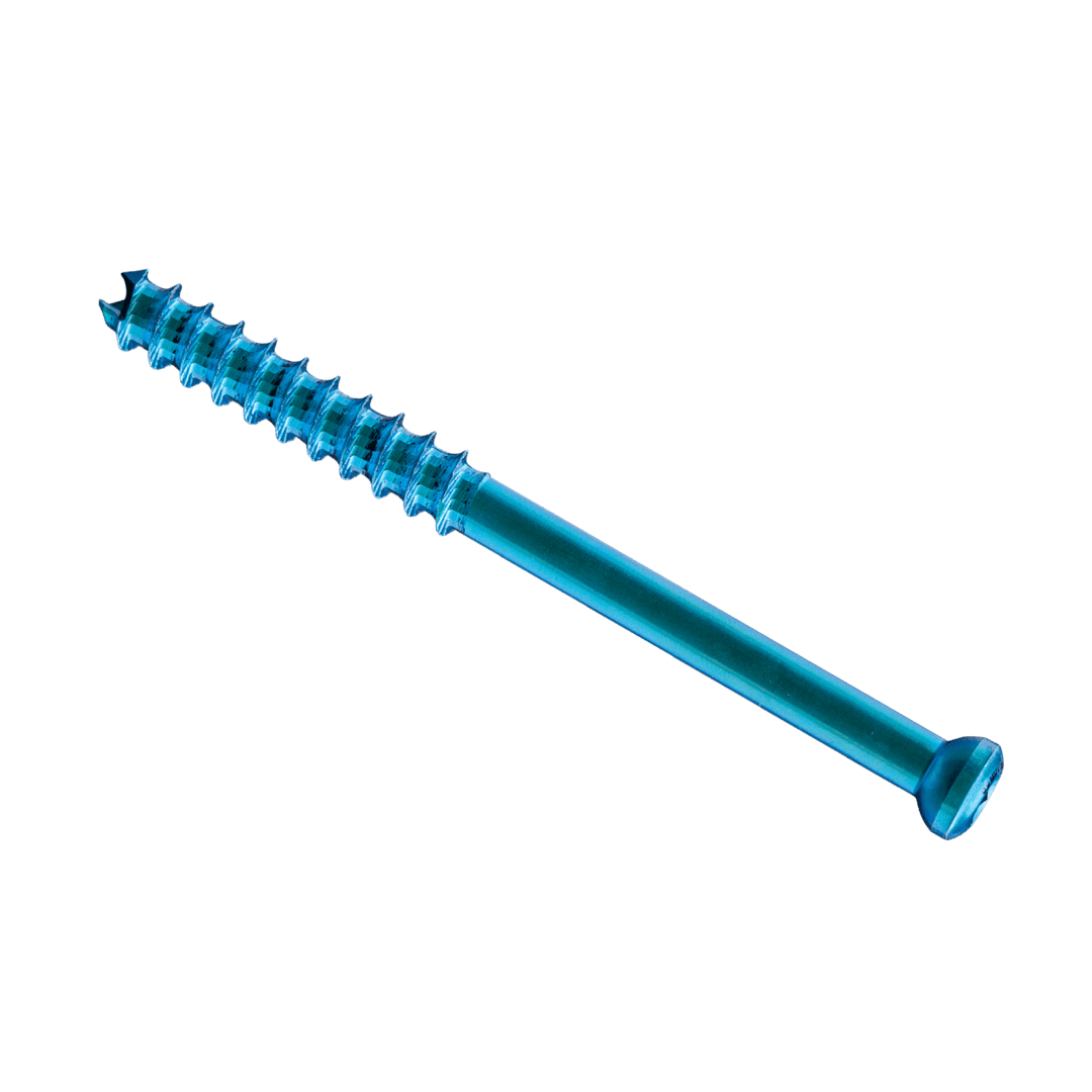 The Future of Personalized Musculoskeletal Reconstruction | restor3d