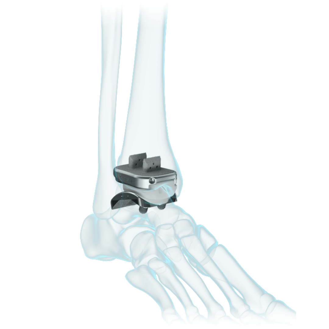 The Future of Personalized Musculoskeletal Reconstruction | restor3d