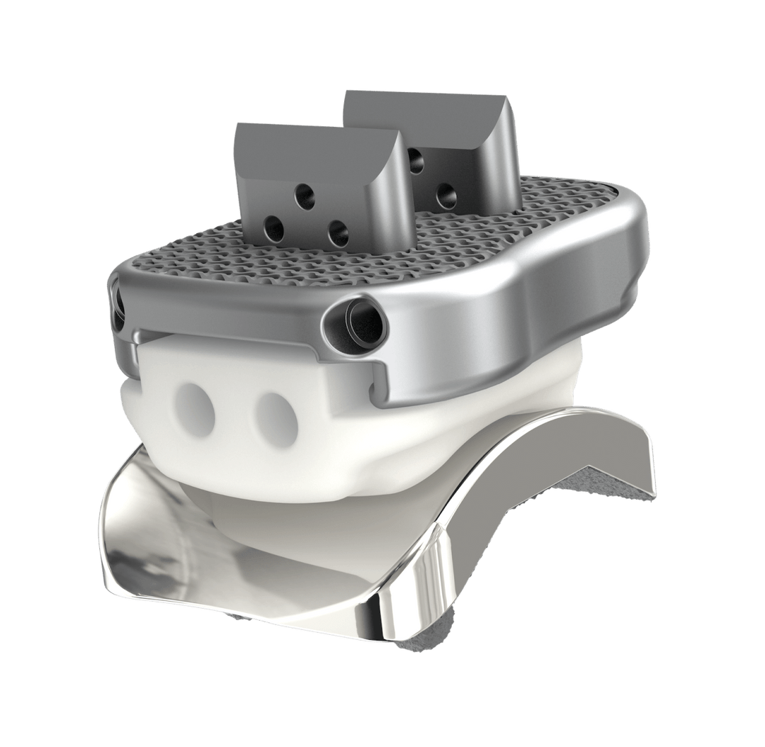 The Future of Personalized Musculoskeletal Reconstruction | restor3d