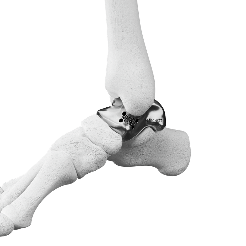 The Future of Personalized Musculoskeletal Reconstruction | restor3d