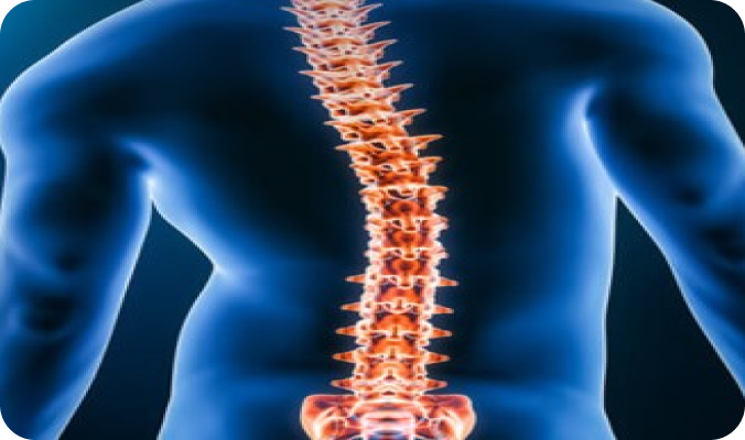 PROLOTHERAPY INJECTIONS FOR SCOLIOSIS CHRONIC PAIN