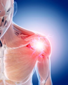 5 WAYS TO KEEP YOUR SHOULDERS HEALTHY