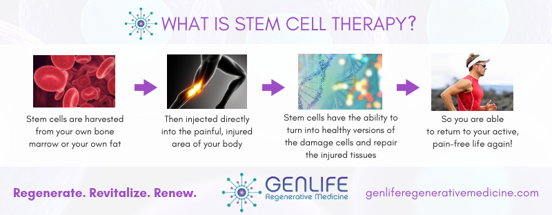 STEM CELL THERAPY: WHAT ARE ITS BENEFITS?