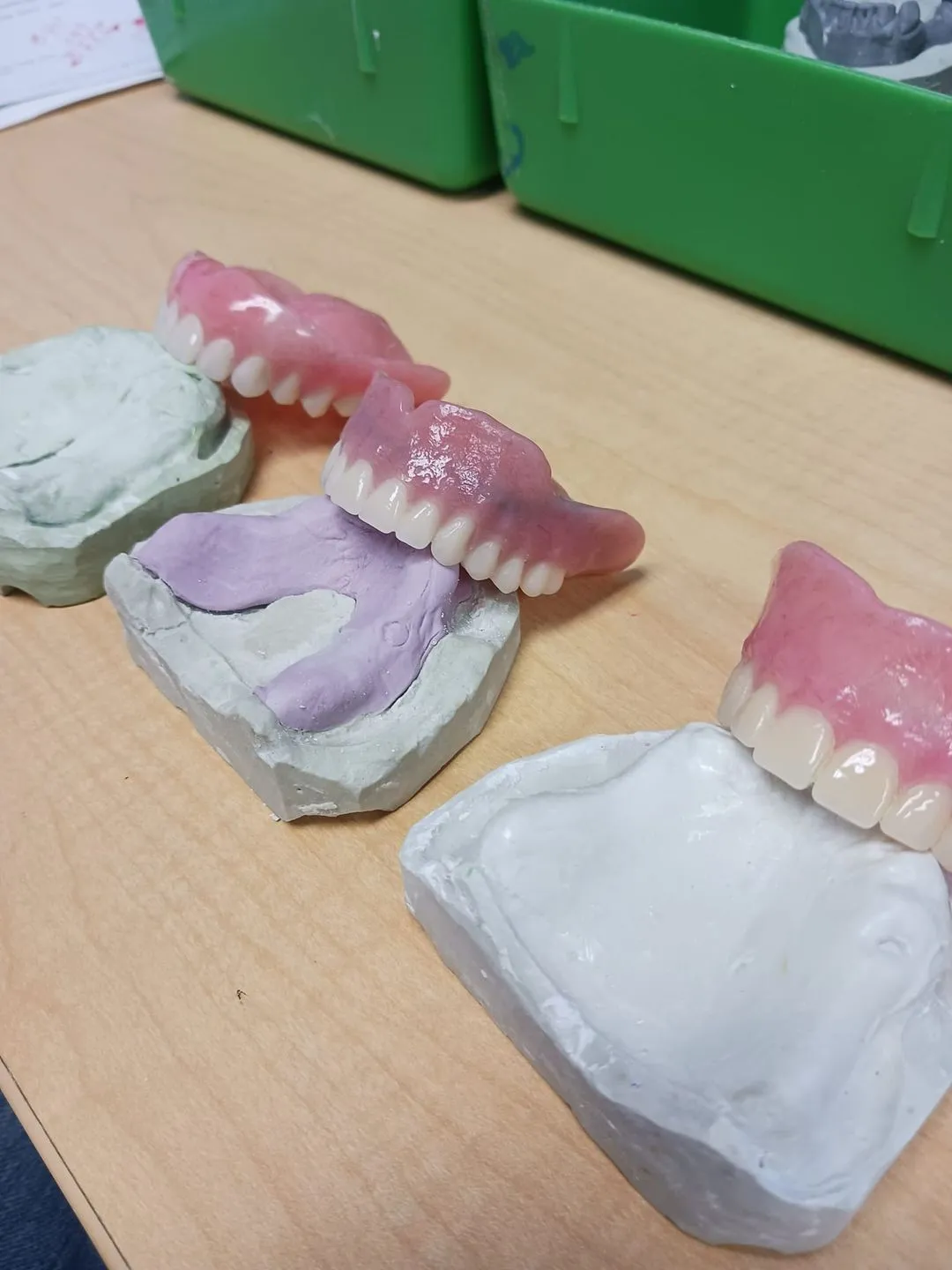 On the Cusp Dental Laboratory | Northfield Denver, CO | Top-Rated ...