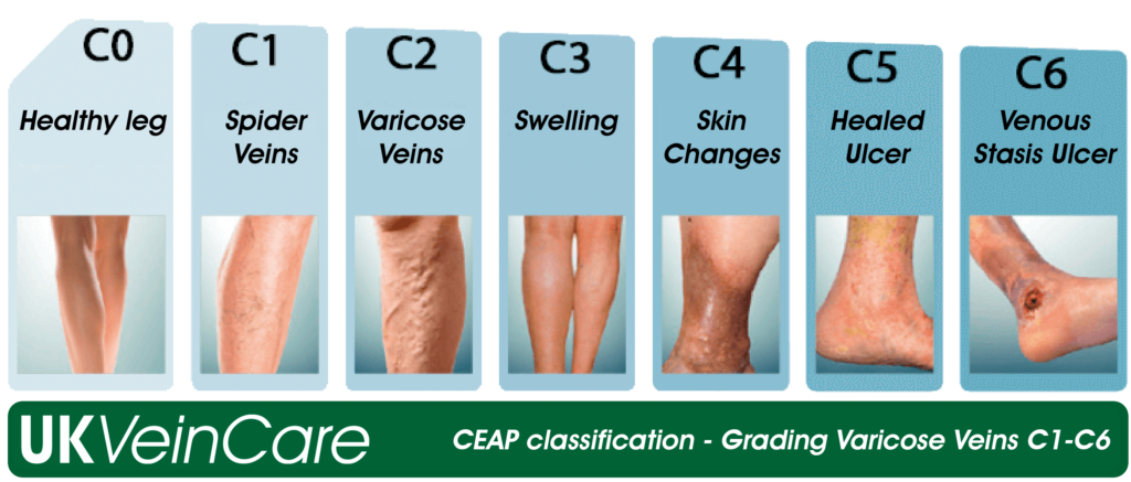 Ukveincare Ukveincare