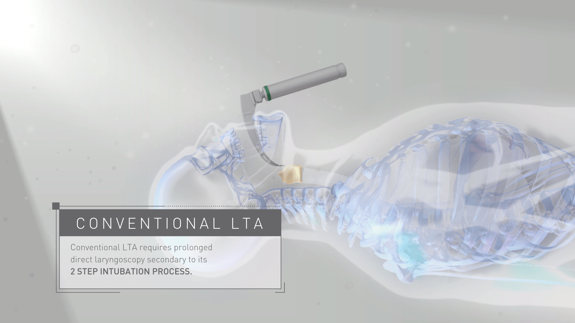 FIRSTLOOK LTA | Guidance Airway Solutions