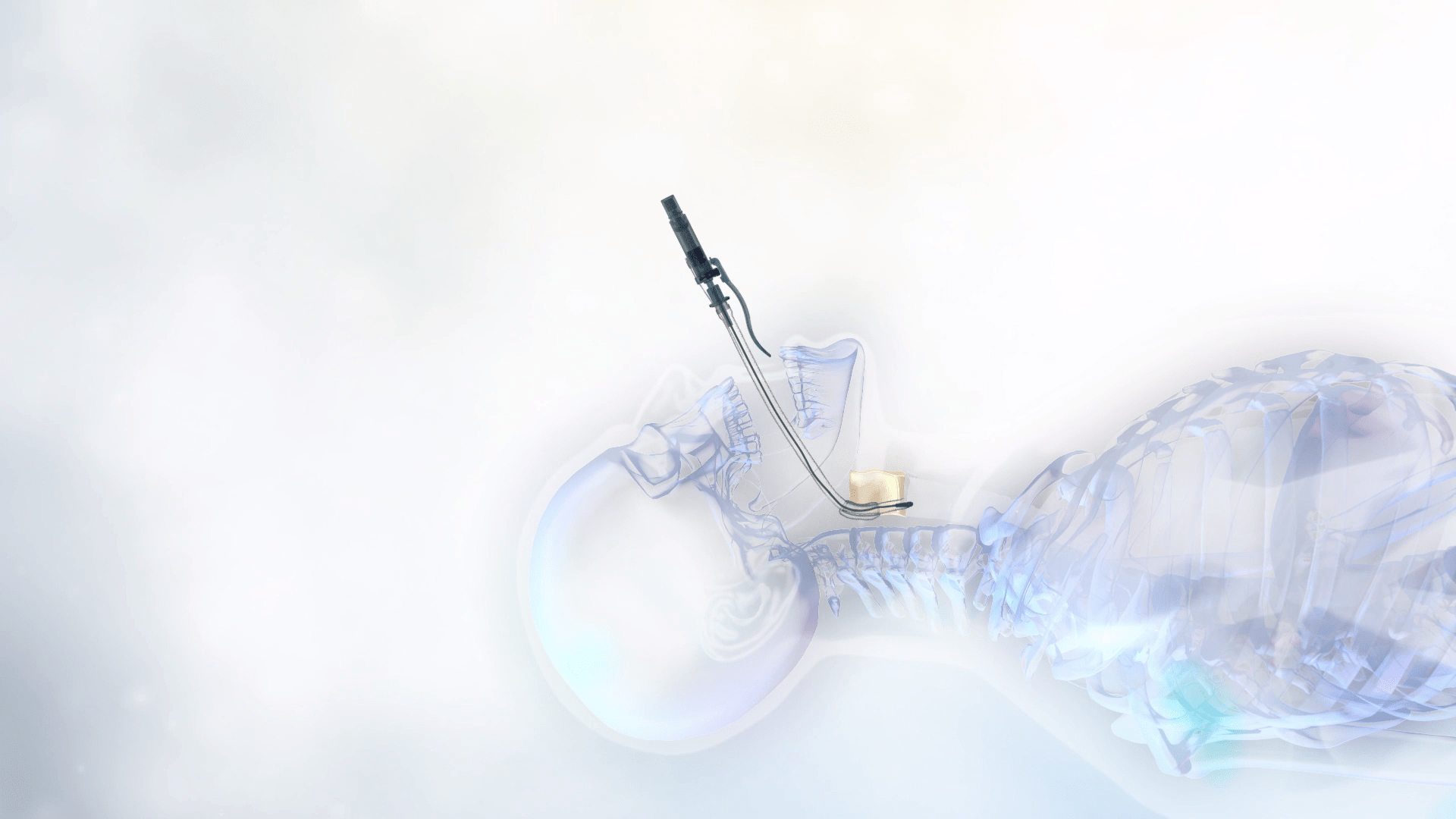 FIRSTLOOK LTA | Guidance Airway Solutions