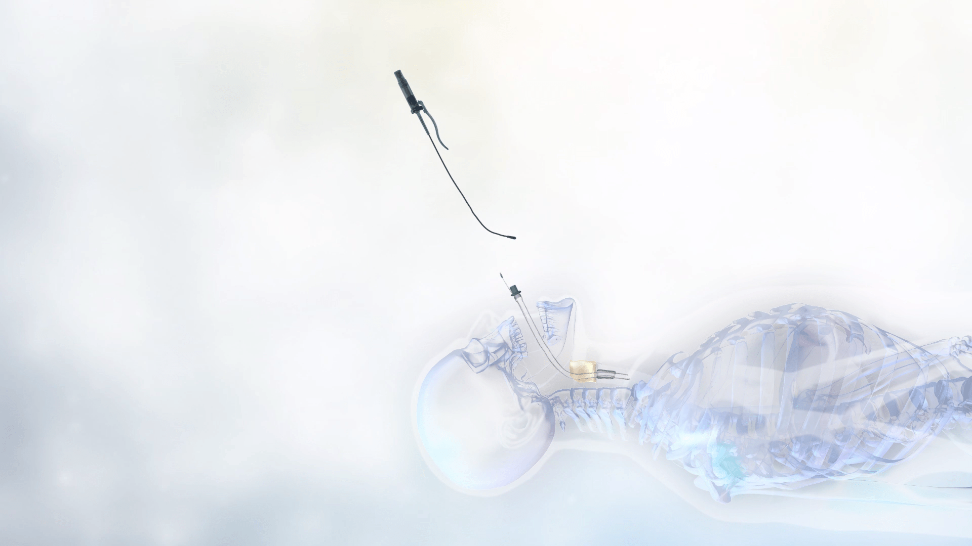 FIRSTLOOK LTA | Guidance Airway Solutions