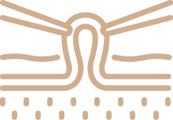 Prijzen voor behandeling van spataderen en beenvaatjes