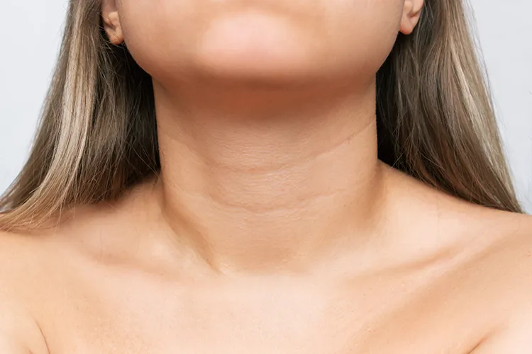 Neck Botox Treatment in Surrey - Wellface®